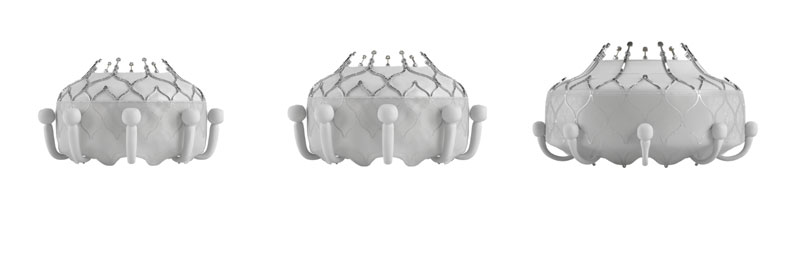 Heart & Vascular Care | TTVR | Powers Health