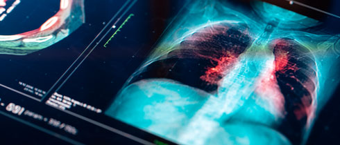 Dr. Raja Devanathan, Pulmonary Medicine, Critical Care Medicine ...