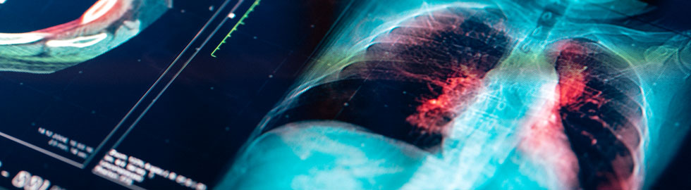 Lung Care (Pulmonology) | Powers Health
