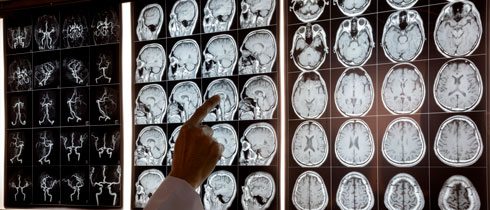 Dr. Christopher Haak, Clinical Neuropsychology | Powers Health