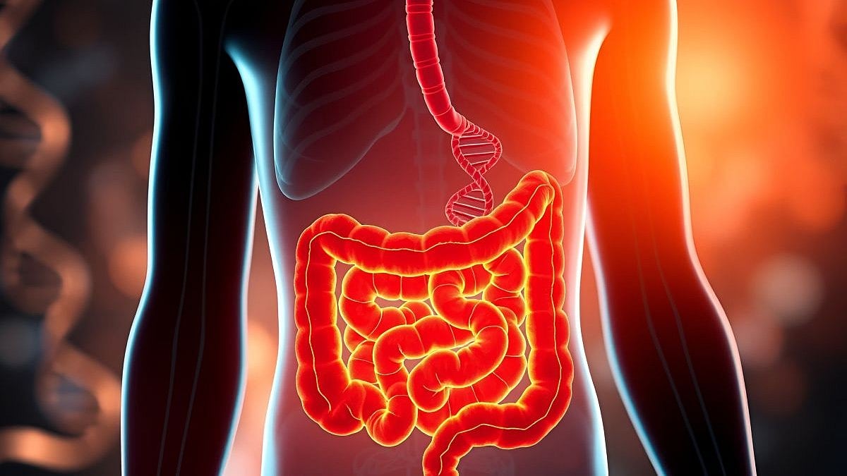 Colon Cancer Now Top Cancer Killer for Americans Under 50 Study Finds ...