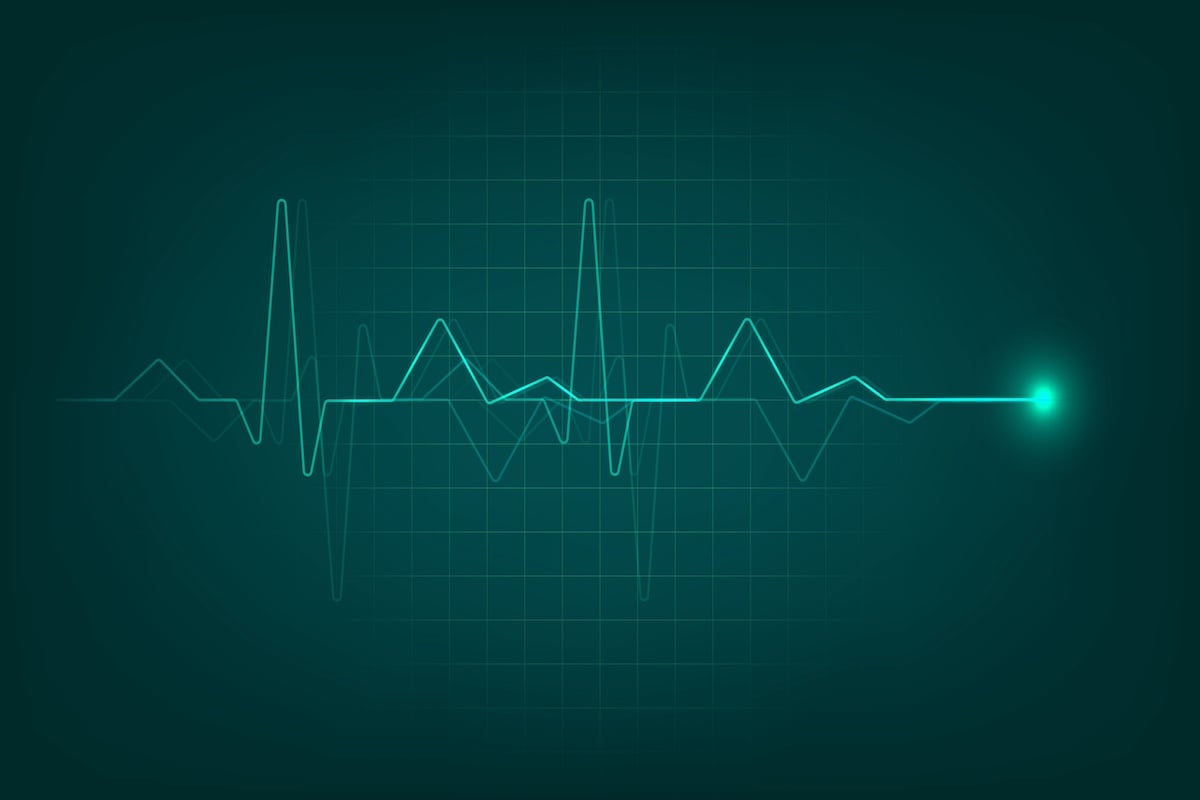A Guide to Electrocardiogram EKG Testing What to Expect | Powers Health